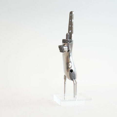 Rare 3D-Printed Fibula Implant | CRMC Ankle Reconstruction
